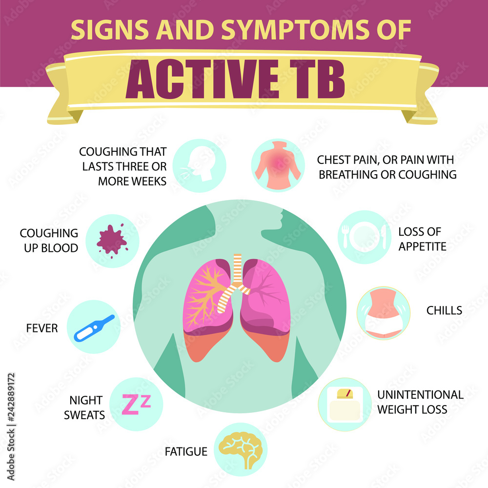 Signs and symptoms of pulmonary tuberculosis. Active TB. Detailed ...
