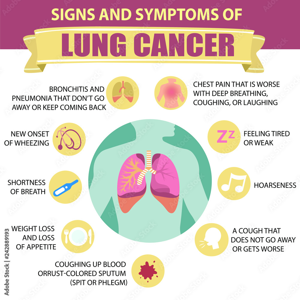 Signs and symptoms of lung cancer. Detailed vector Infographic. Human ...