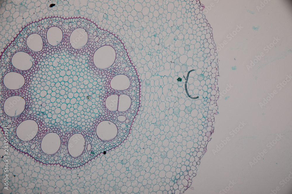 Cross-section Dicot, Monocot and Root of Plant Stem under the ...