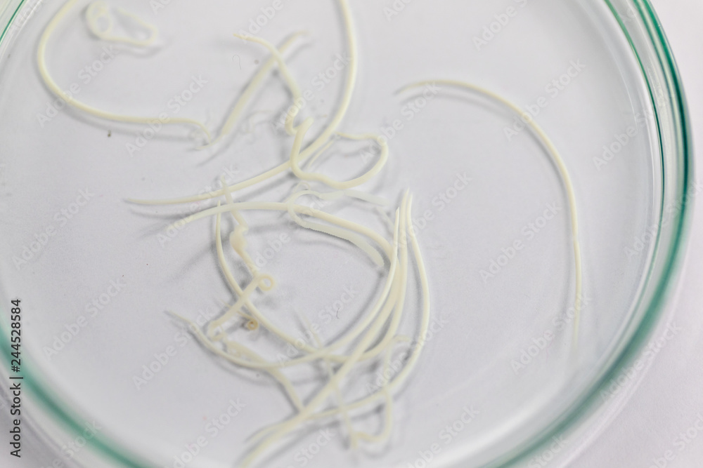 Ascariasis is a disease caused by the parasitic roundworm Ascaris ...