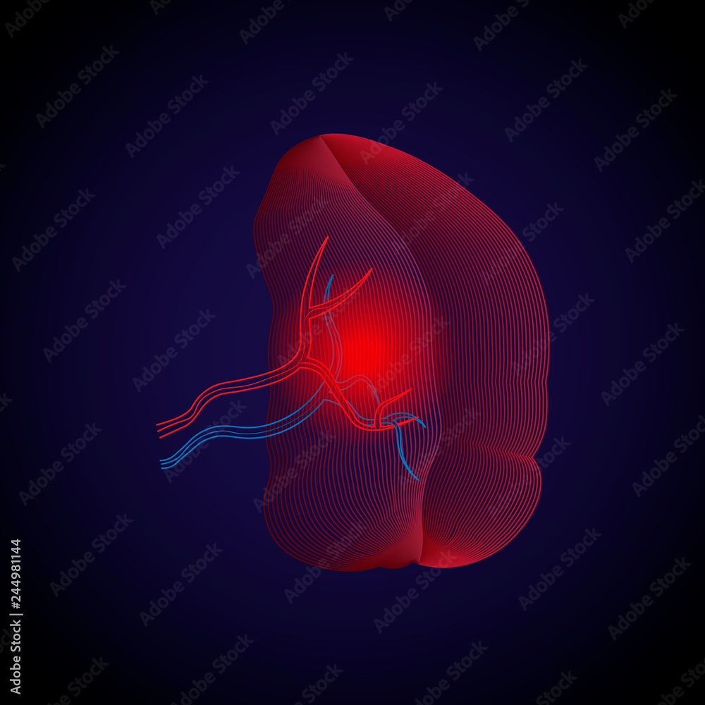 Medical illustration of the lines.. X-ray effect of spleen disease ...