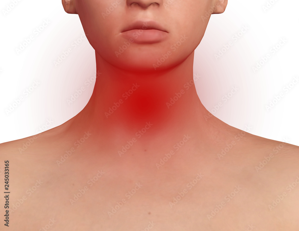 Thyroid gland exposed on the neck of a woman with endocrine disruption ...