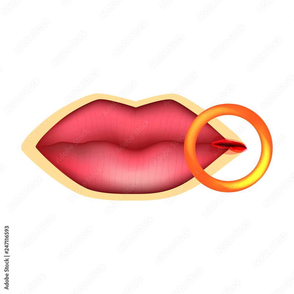 Cracks at the corners of the lips. Dry chapped lips. Wounds in the ...