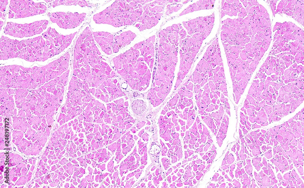 Stock-Foto „Histology of human tissue, show necrosis of skeletal muscle ...