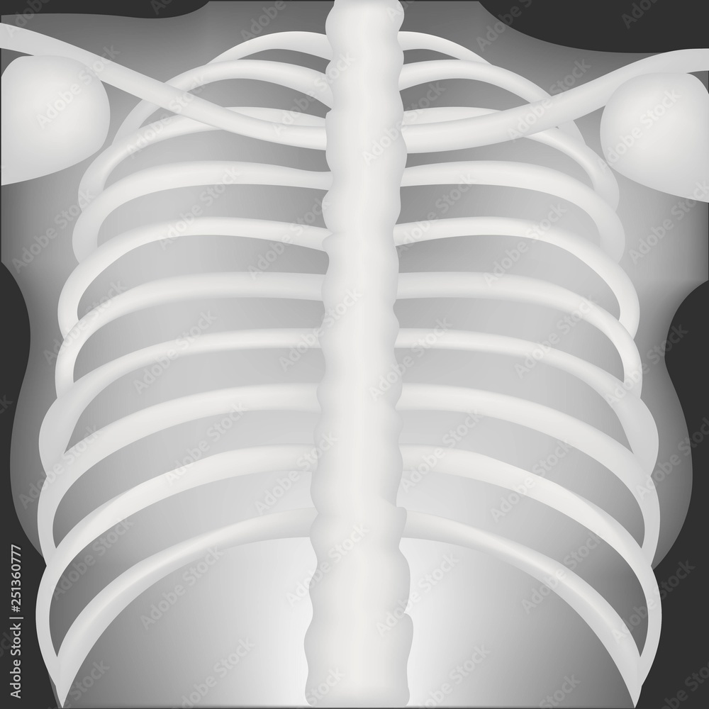 Stock-Illustration „Chest X-rays in upright position for medical study ...