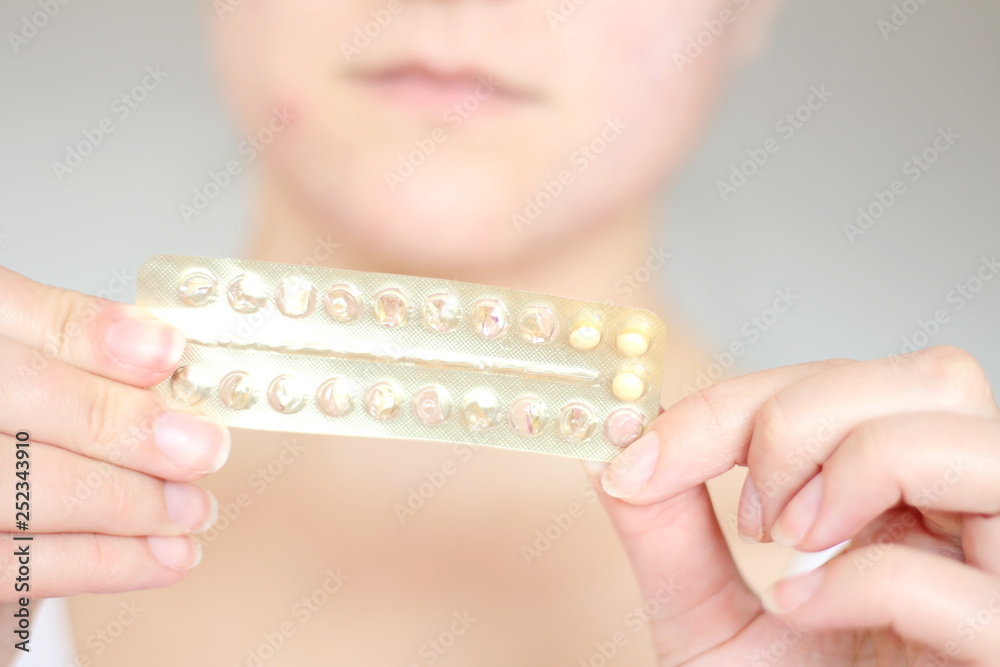 Acne on the face of young women. Improper therapy has led to a severe ...