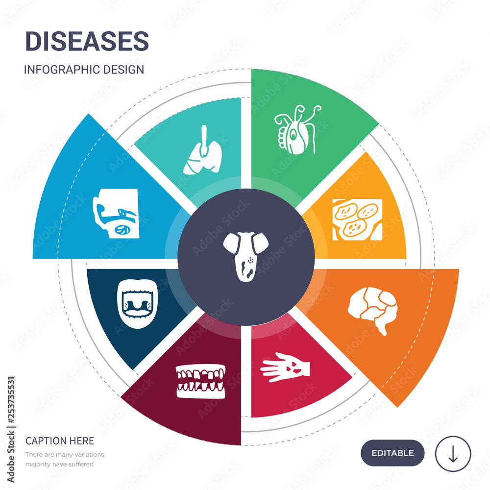 set of 9 simple diseases vector icons. contains such as thrush, thymoma ...