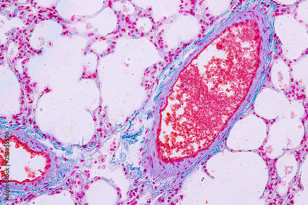 lungs tissue under microscope