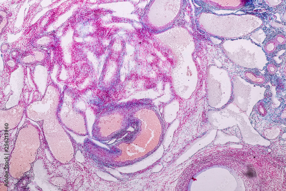 Education anatomy and Histological sample Ovary of rabbit Tissue under ...