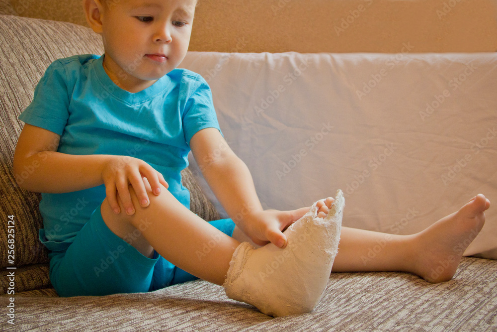 Broken leg in cast of little boy.Little Child Boy With Plaster Bandage ...
