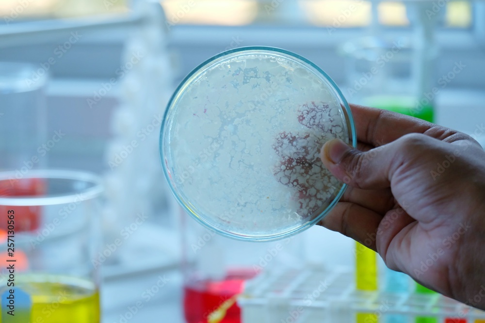 Petri dish for culture in laboratories. and Bacterial colonies culture ...