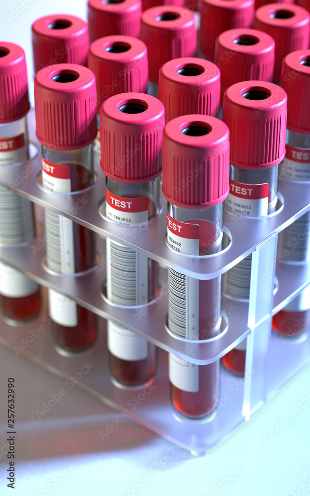 Tray tubes with blood samples labeled,rack of blood tubes, 3d rendering ...