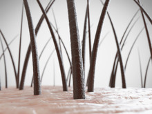 Hair Follicle Free Stock Photo - Public Domain Pictures