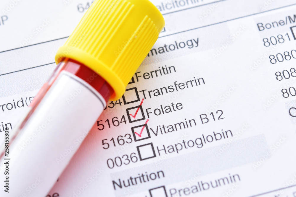 Foto de Stock Blood sample tube with laboratory requisition form for ...