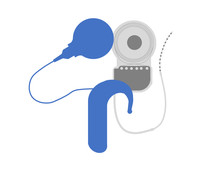 Cochlear Implant Free Stock Photo - Public Domain Pictures