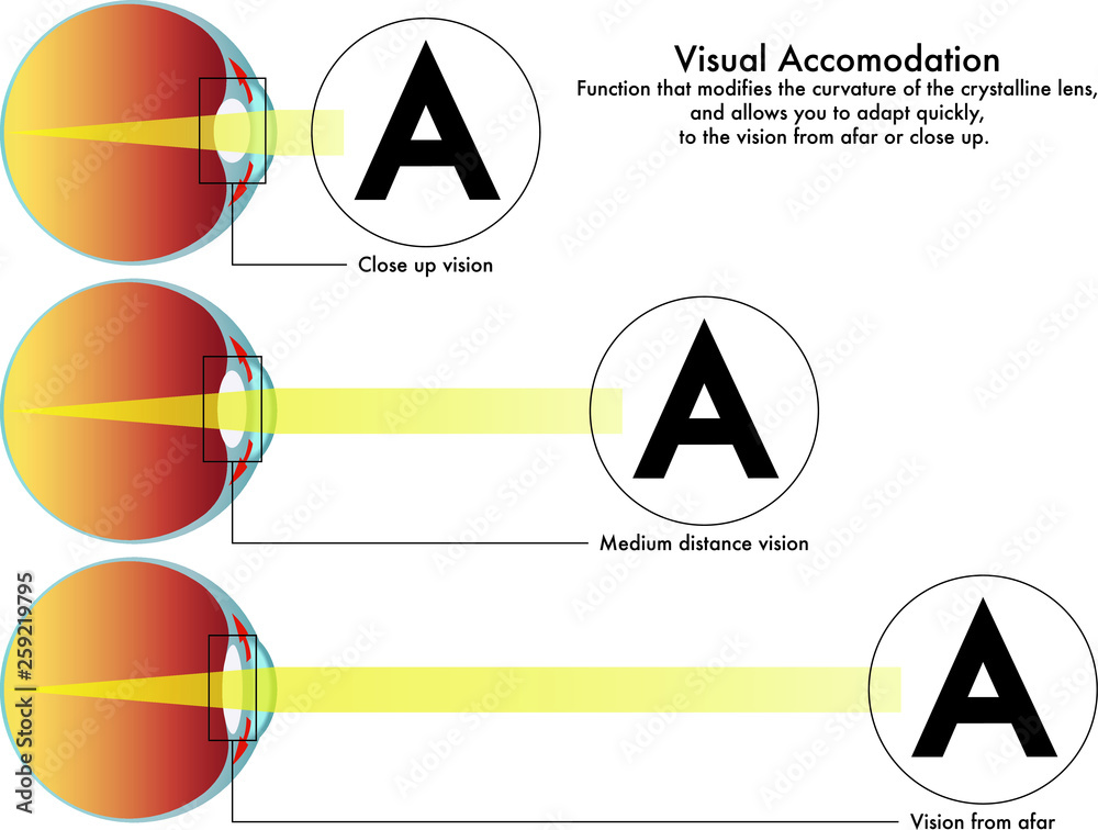 A medical diagram of visual accommodation, the function that modifies ...