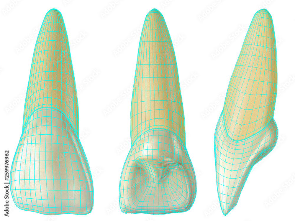 maxillary central incisor tooth in the vestibular, palatal and lateral ...