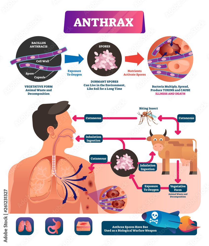 Anthrax Vector Illustration Labeled Medical Infection Disease Cycle