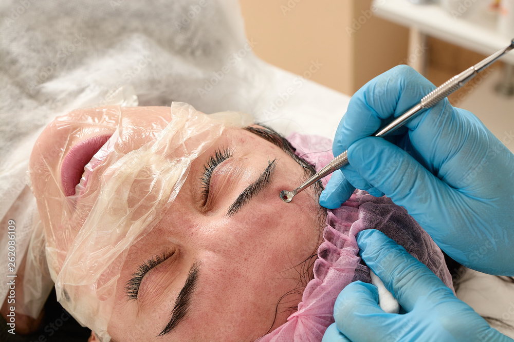 Young woman in beauty salon does manual face cleaning. Manual removal ...