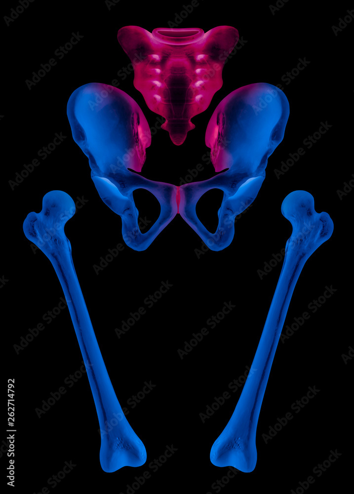 X-ray of separate human hip and femur bone anterior view red highlight ...