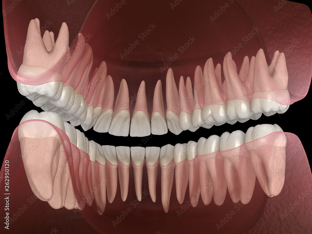 Ilustración de Stock Morphology of mandibular and maxillary human gum ...