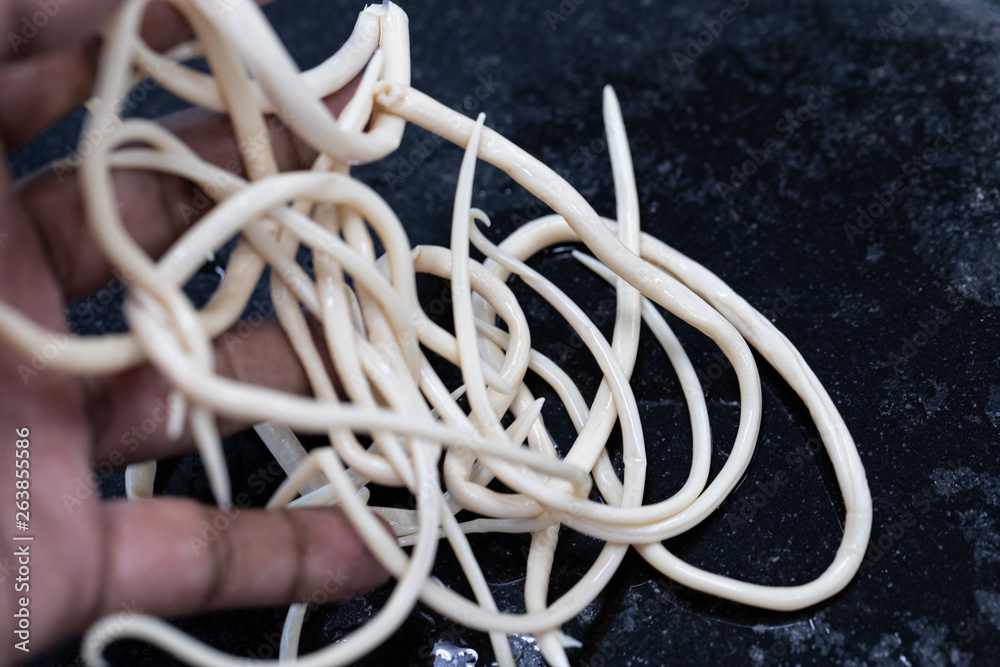 Ascariasis is a disease caused by the parasitic roundworm Ascaris ...