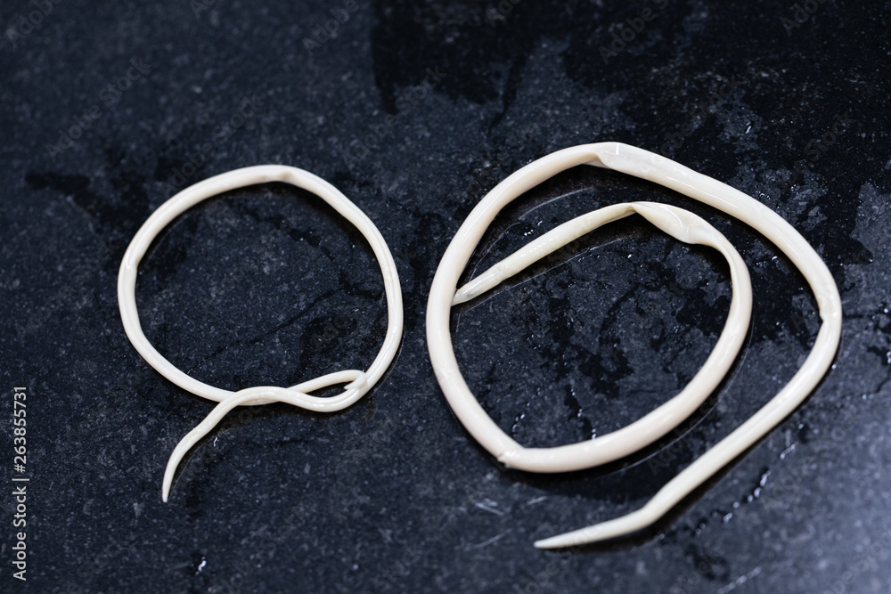 Ascariasis is a disease caused by the parasitic roundworm Ascaris ...