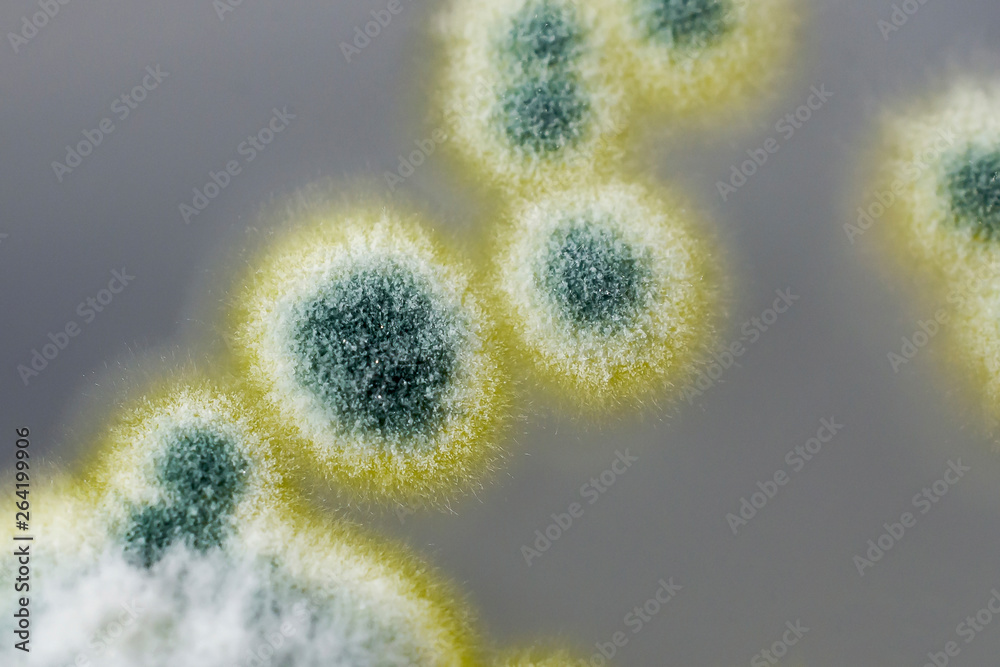 Colonies of Penicillium fungi grown on Sabouraud Dextrose Agar ...