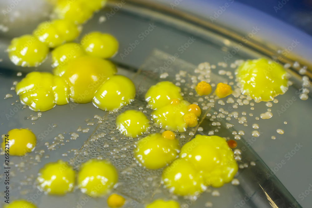 Bacteria grown from skin smear, colonies of Micrococcus luteus and ...