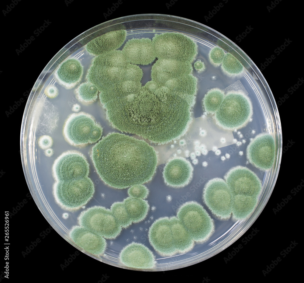 Colonies of Penicillium fungi grown on Sabouraud Dextrose Agar, SDA ...