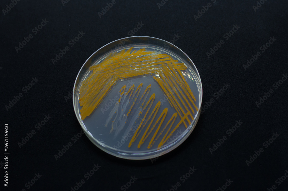 Orange colonies of Actinomyces bacteria on agar plate Stock Photo ...