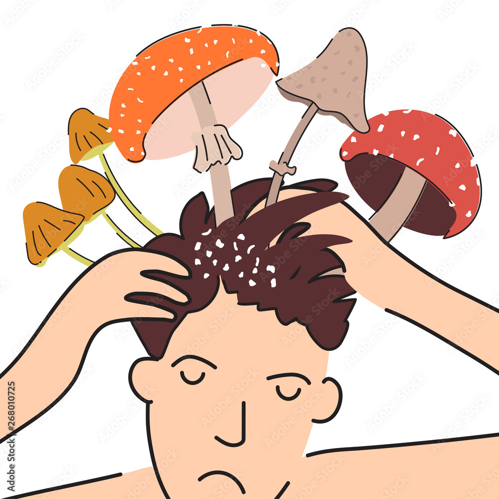 Fungal skin diseases. Ironic poster shows the problem of dandruff on ...