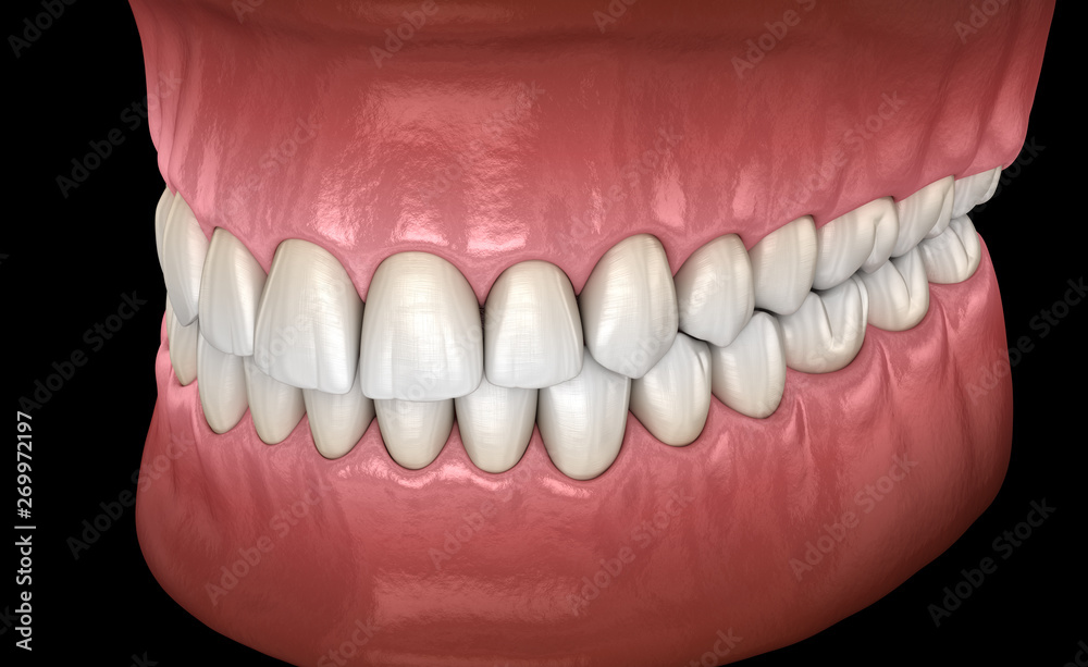 Healthy human teeth with normal occlusion, side view. Medically ...