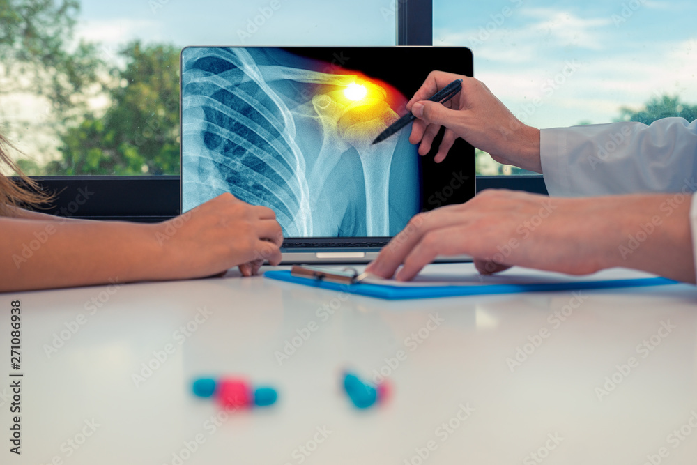 Doctor showing a x-ray of chest with pain on the shoulder on a laptop ...