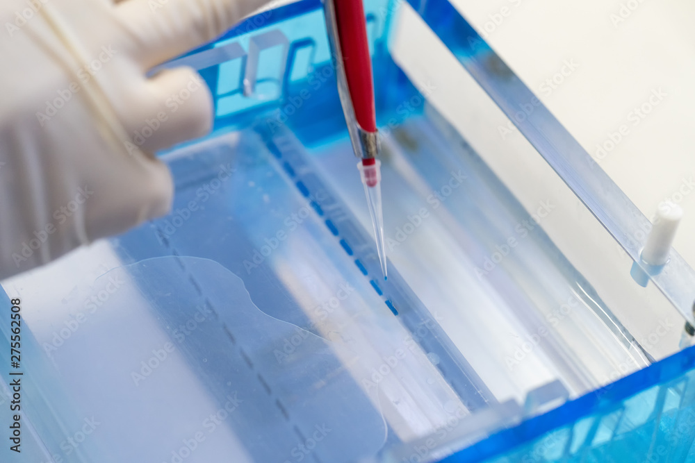 Molecular technique gel electrophoresis for DNA sample method decrypt ...