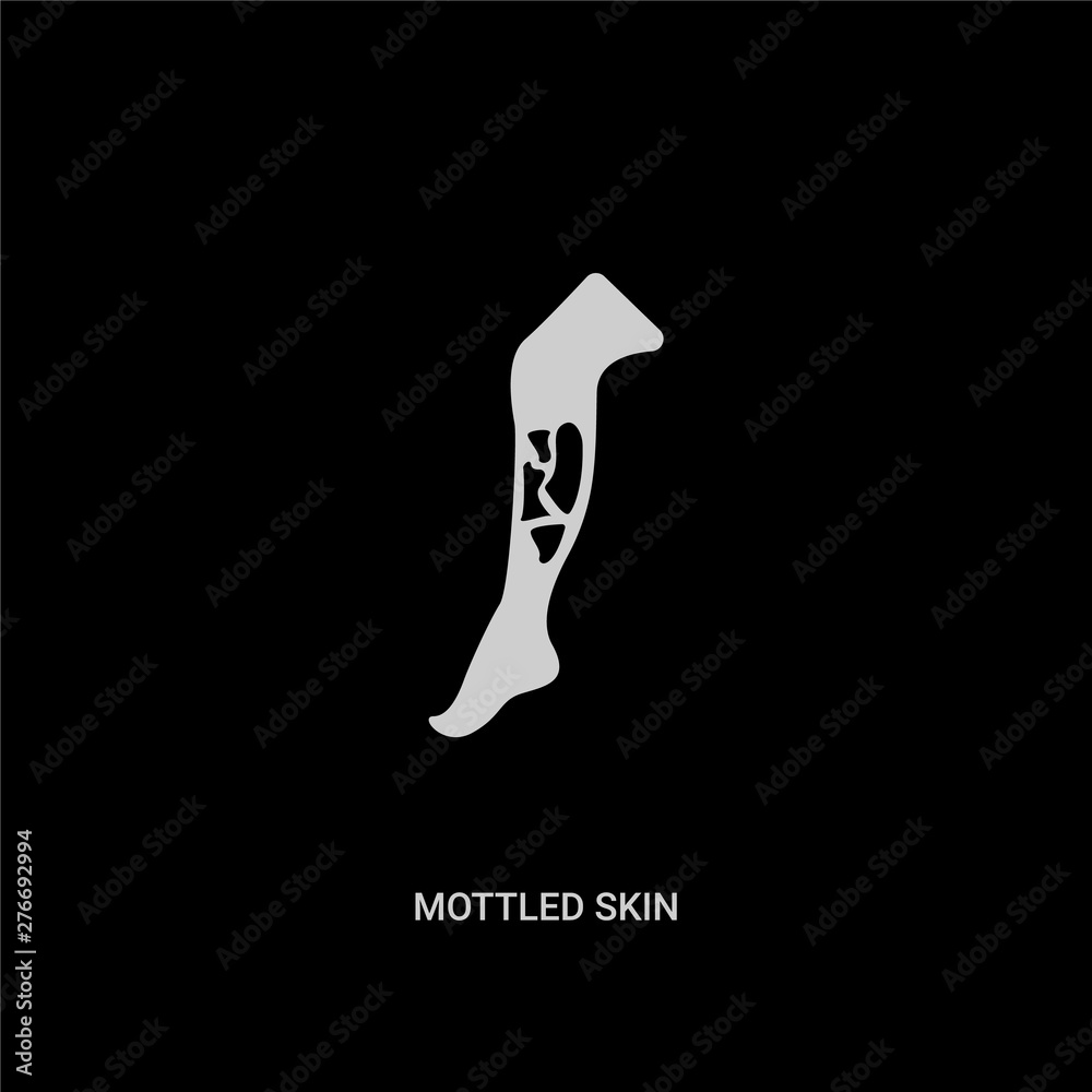 white mottled skin vector icon on black background. modern flat mottled ...