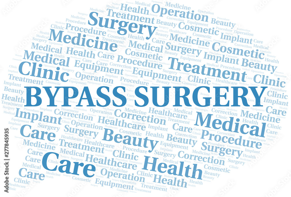 Bypass Surgery word cloud vector made with text only. の Stock ベクター ...