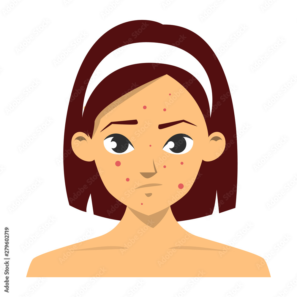 Beatiful girl with acne. Red pimple on the face. Stock Vector | Adobe Stock