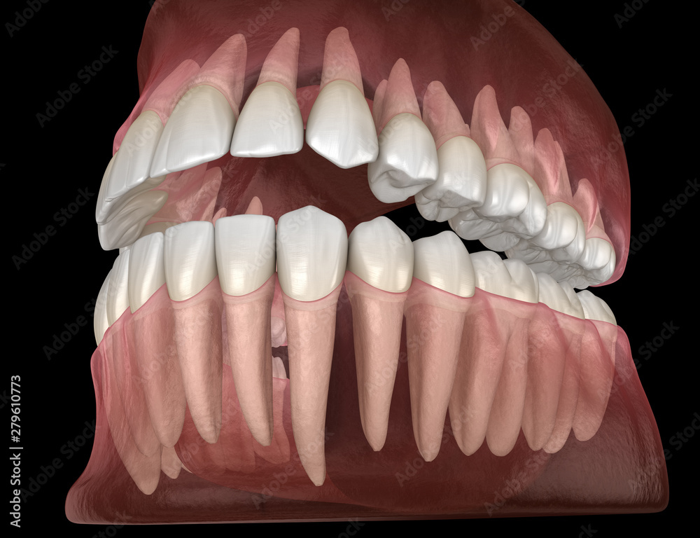 Morphology of mandibular and maxillary human gum and teeth. Medically ...