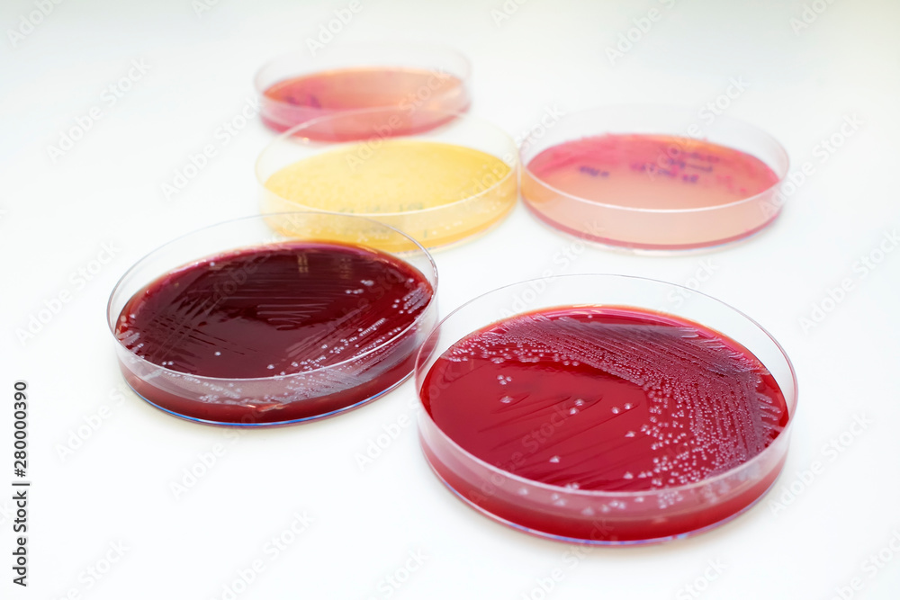 Escherichia coli (E. coli) culture in petri dish with macconkey agar ...
