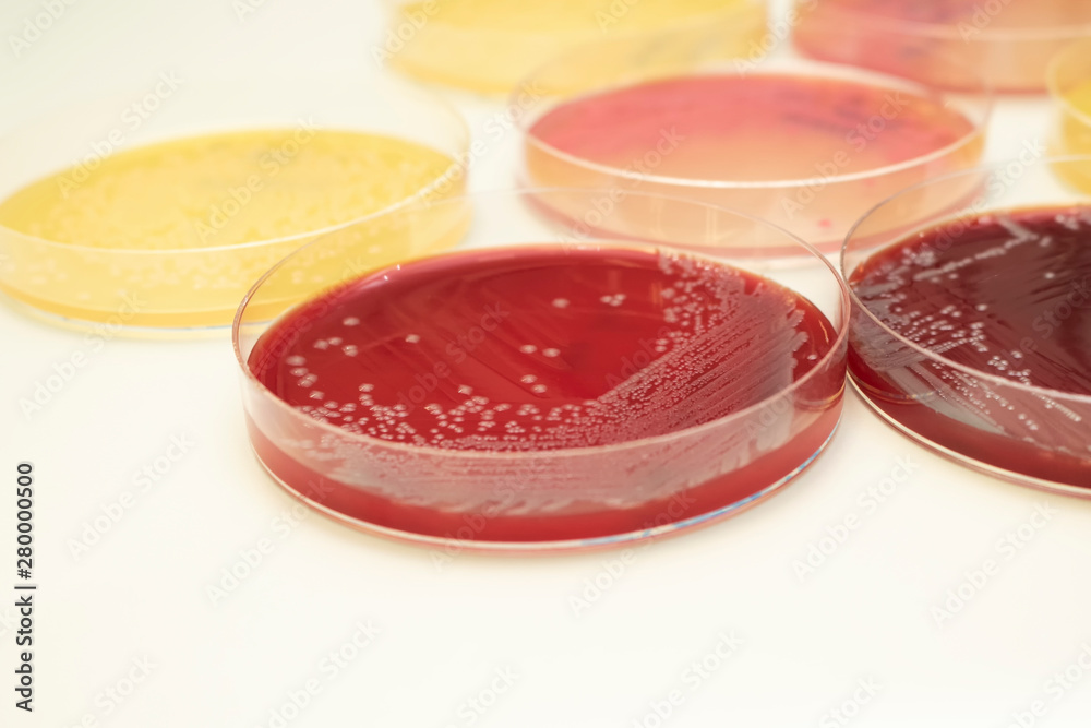 Foto de Stock Escherichia coli (E. coli) culture in petri dish with ...