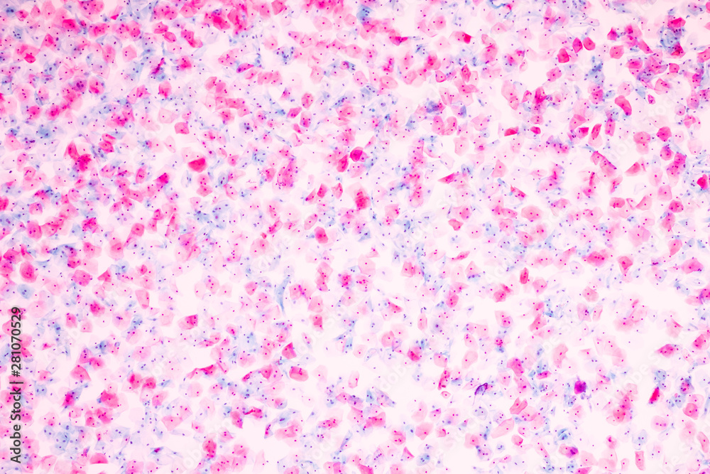 View in microscopic of normal human cervix cells.Squamous epithelium ...