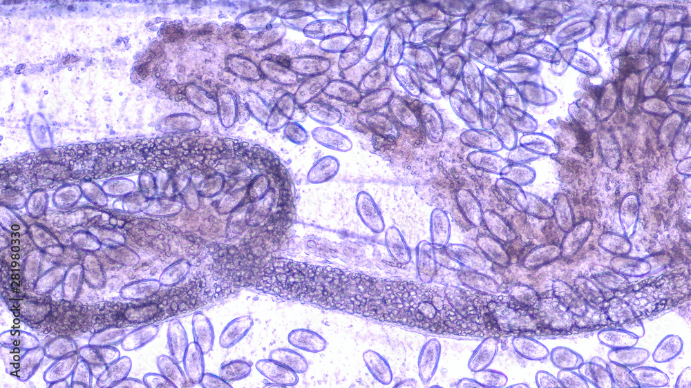 Microscopic image (whole mount prep) of a pregnant pinworm, scientific ...