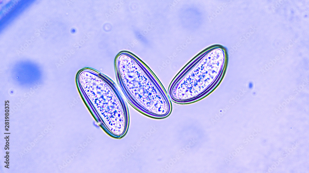 Microscopic image of the eggs of a pinworm (enterobias vermicularis), a ...