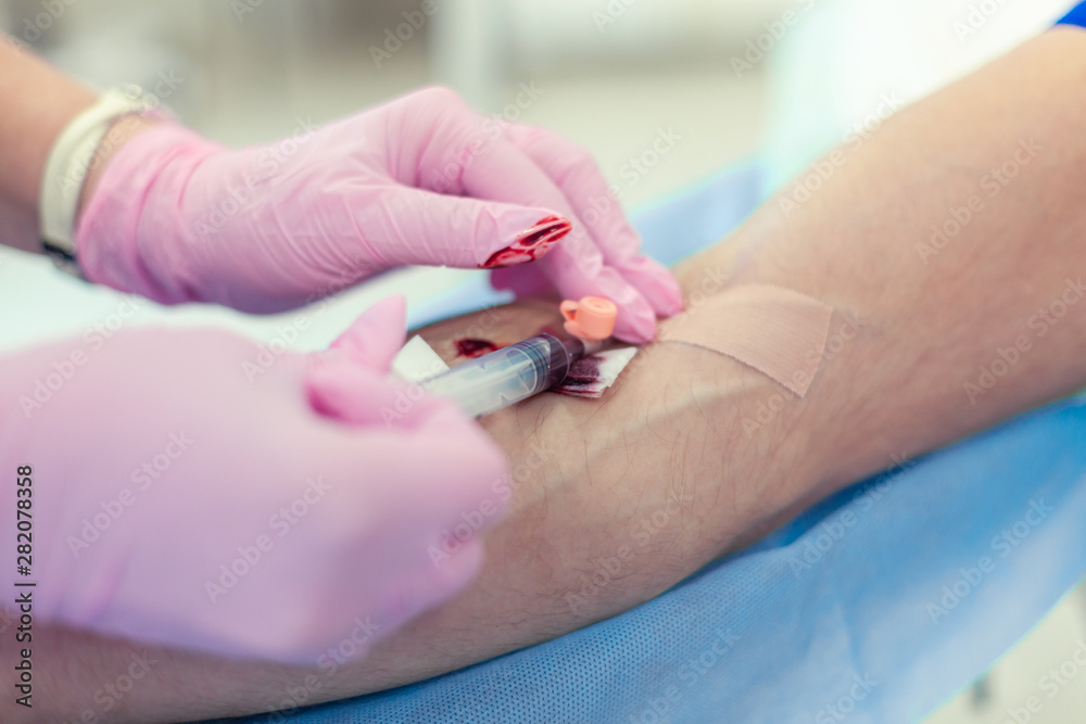 Preparation for surgery. Medical nurse with pink latex gloves inputs ...