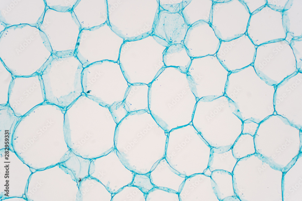 Cross sections of plant stem under microscope view show Structure of ...