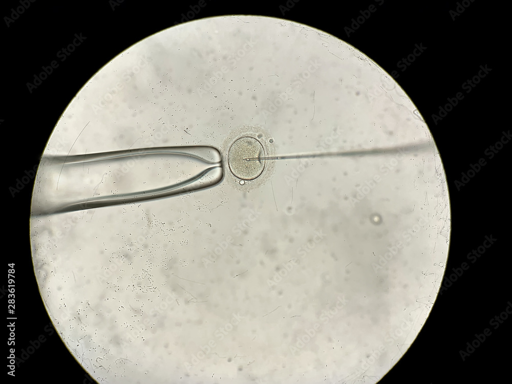 View through microscope at in vitro fertilization process Stock Photo ...