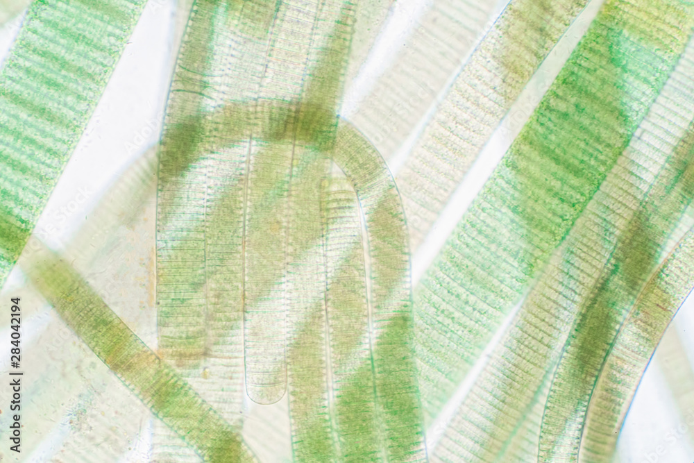 Filamentous of cyanobacteria (Oscillatoria) under microscopic view for ...