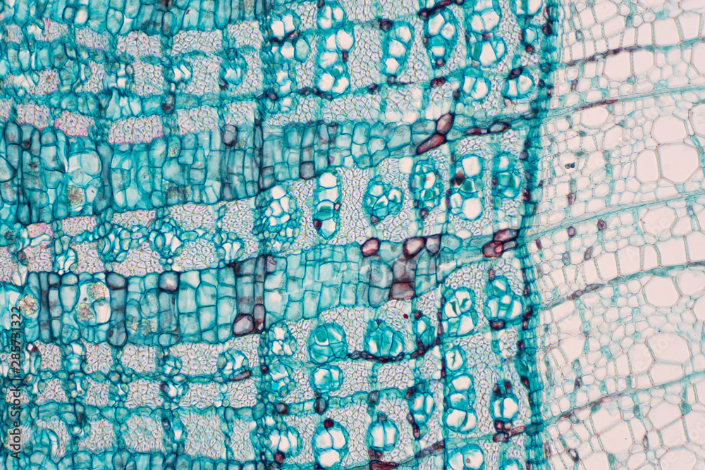 Cross section - Phloem is a type of tissue in vascular plants that ...