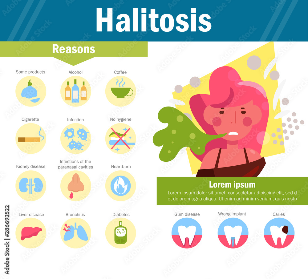 Halitosis Vector. Cartoon. Isolated art on white background. Flat Stock ...